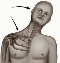 Physiotherapy and Anatomy: Outcomes of surgical paraclavicular thoracic ...