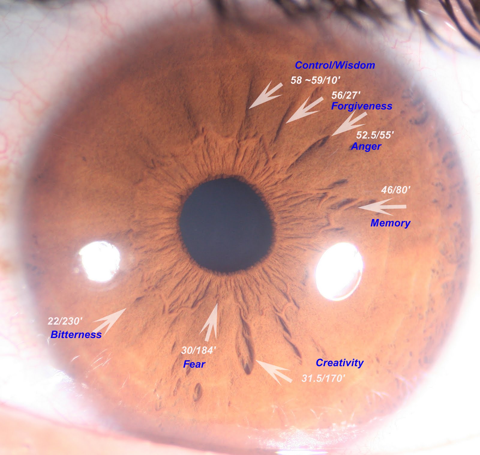 Modern & Multidimensional Iridology: Time Risk & Emotional Dynamics of ...