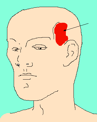 Phil osophy: Seven Targets on The Head.