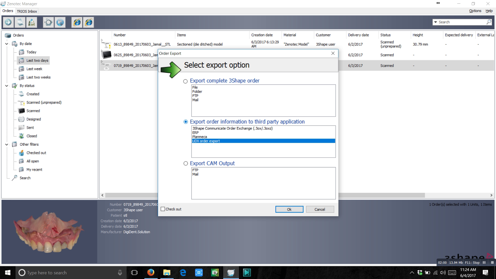 How you can convert Trios dcm files into stl with 3shape part 2