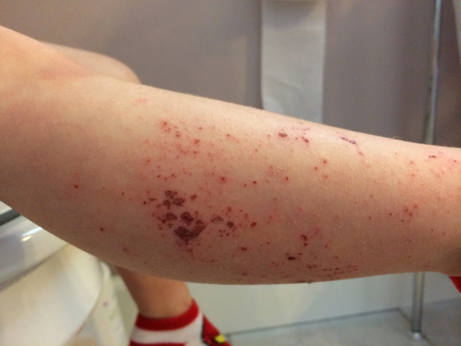 Autism Road to Recovery: April 2015