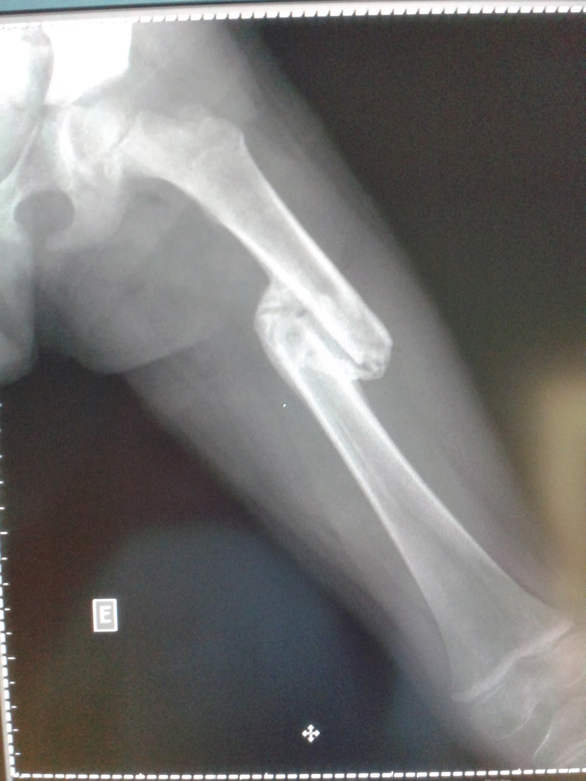 Dicas De Radiologia Tudo Sobre Radiologia Veja Quais SÃo Os