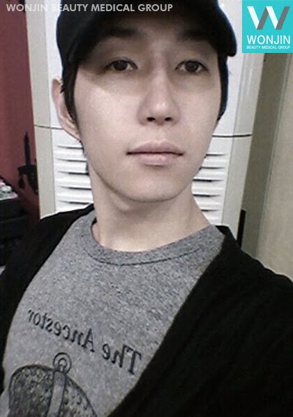 [Real Diary] A Handsome Nose to Complete My Handsome Looks - 짱이뻐!