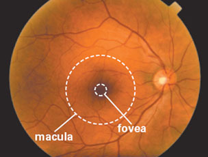 Low Vision Eyeglasses LowVisionEyeglasses.com: Guide for Macular ...