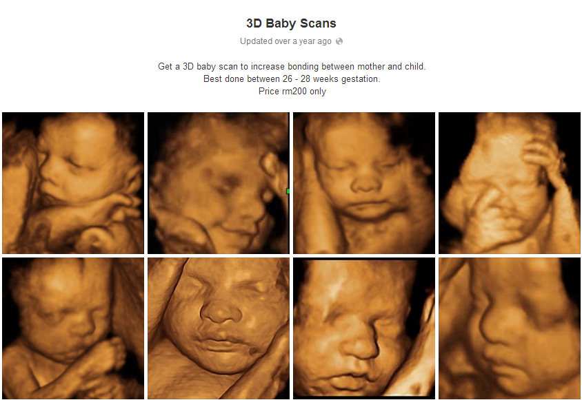 Hospital Untuk Bersalin: SELANGOR : NR PUSAT DIAGNOSTIK / SCAN BAYI 3D/4D