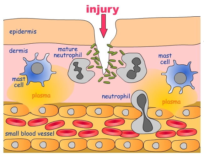 Mozahedul Islam's blog: Inflammation