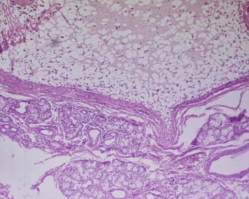 PatOral UFC: Imagens Histopatológicas