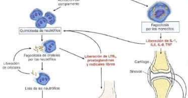 fisiopatologia-de-la-gota.bmp