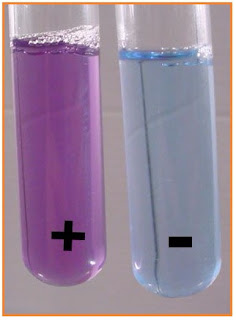 Jendela informasi: Uji Urin Menggunakan Benedict dan Biuret