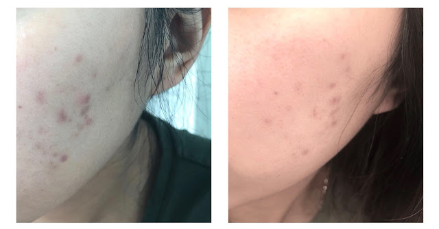 The Skincare Routine That Changed My Skin