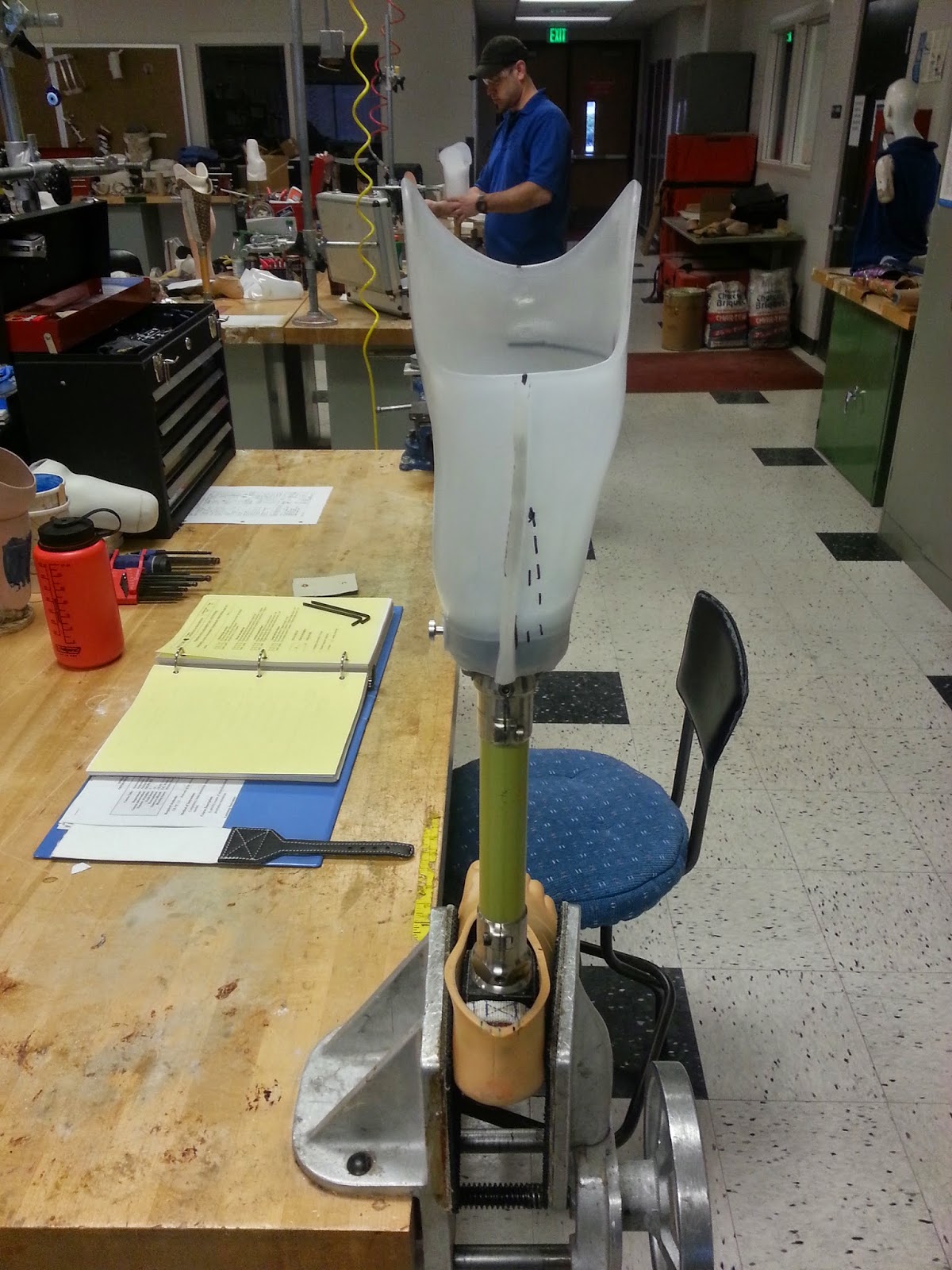 Prosthetic Projects: Locking liner Carbon Fiber transtibial ...