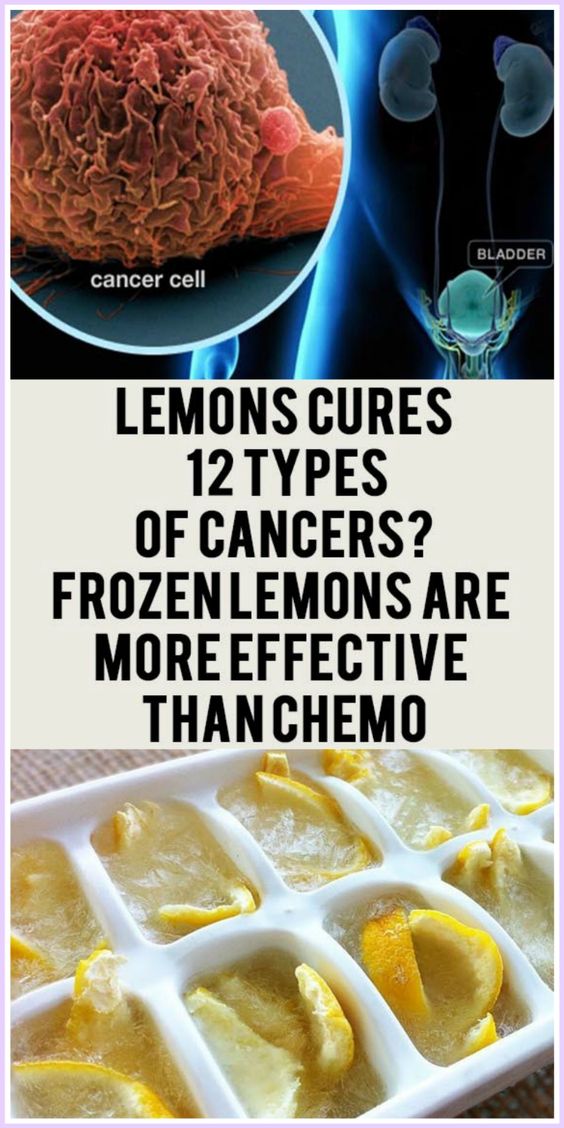 Lemons Cures 12 Types Of Cancers? | Frozen Lemons Are More Effective ...