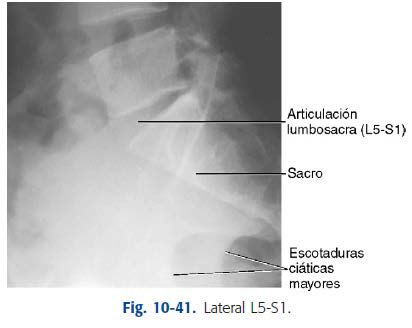 PRODUCCION Y TRATAMIENTO DE IMAGENES DIAGNOSTICAS: CAPITULO COLUMNA ...