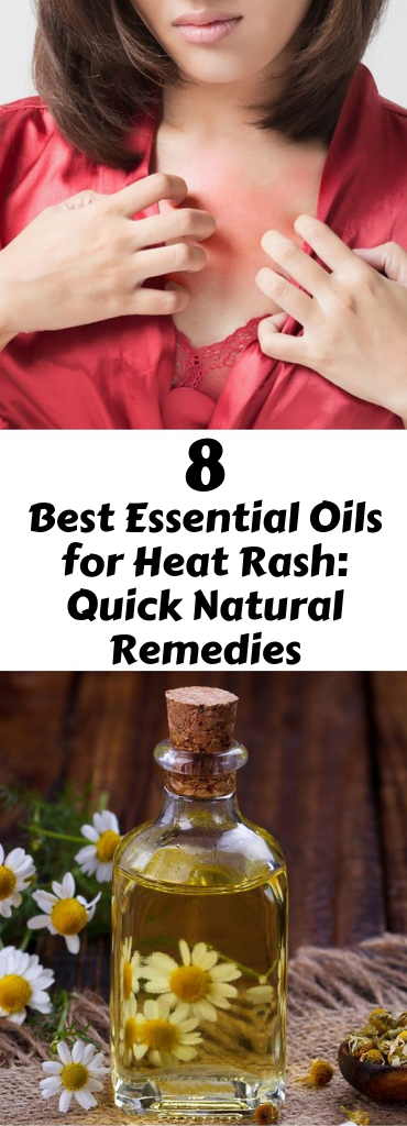 8 Best Essential Oils for Heat Rash : Quick Natural Remedies ...