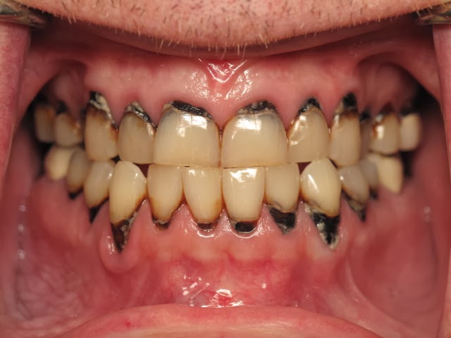 DrChetDMD: Rampant Decay