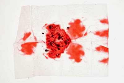 කන්‍යාබාවය හා ලේ පැල්ලම් - hymen and Blood mark - හිරු - සඳු