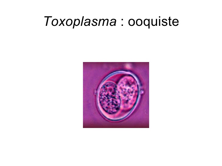 TOXOPLASMA GONDII: toxogondii.blogspot.com