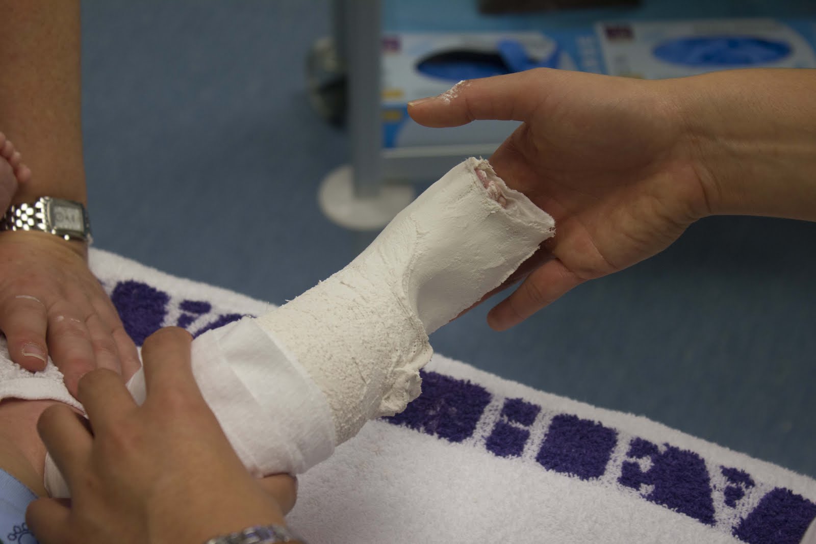 Little Joes Feet: Second Set of Casts