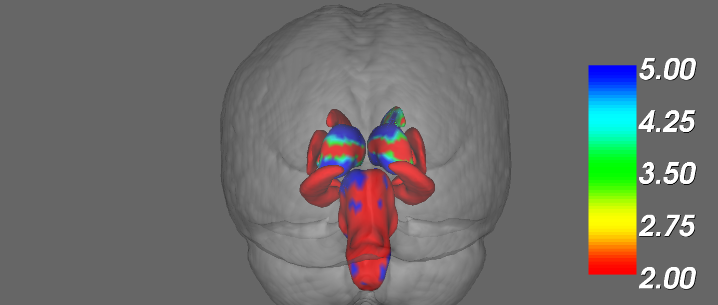 Neuroimaging Made Easy : Batching FSL tools and utilities using ...