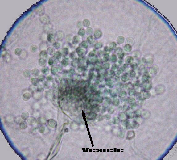 Fungal Structures and Mycology Terminologies Essential for ...