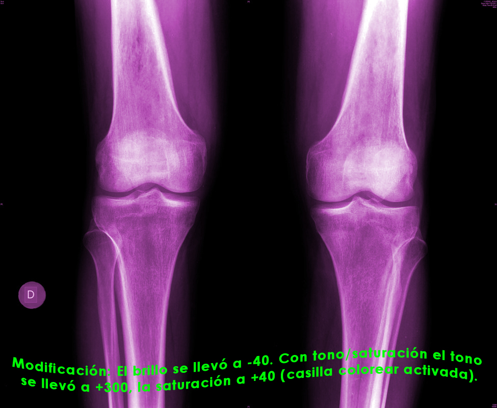 Tu Espacio Radiológico: Proyecciones Básicas de Rodilla