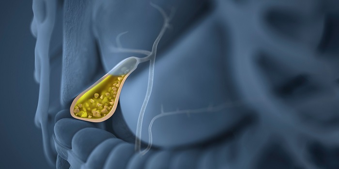 Ataque da Vesícula Biliar: Como é, Sintomas e Tratamentos