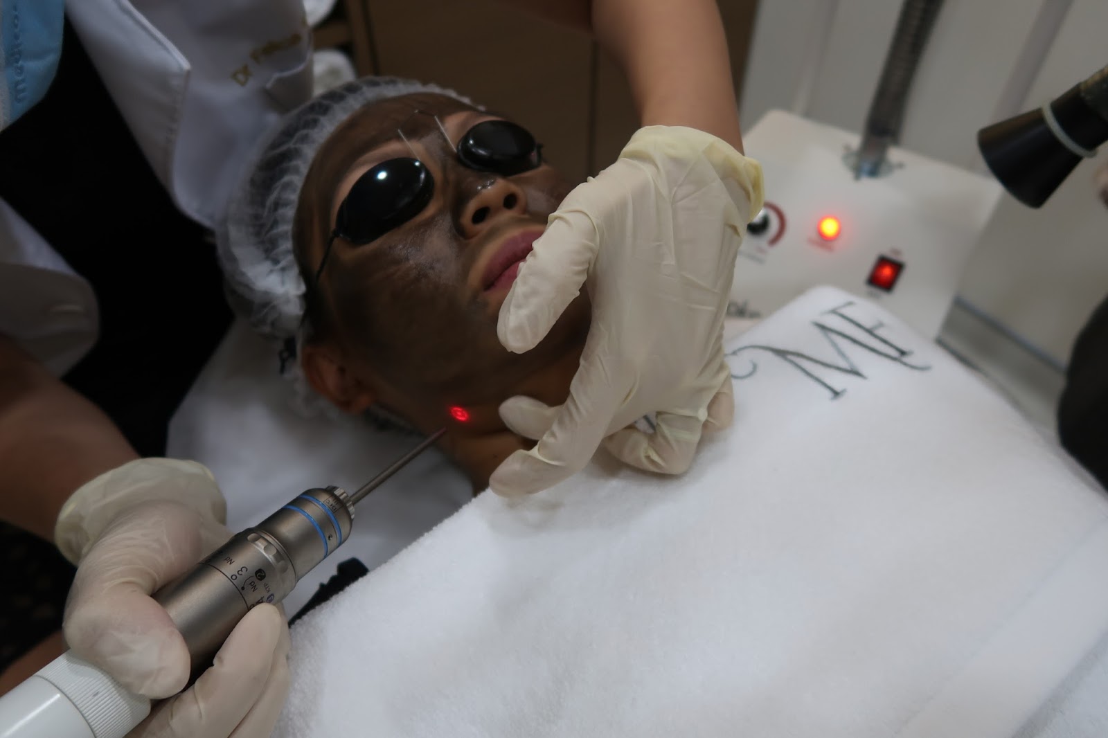 Travel Junkie Mum: Carbon Laser Facial Review - Clinic MF