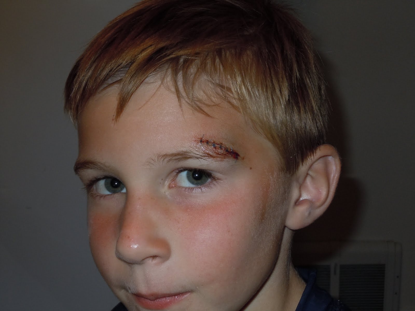 Life at 169: The Wounds