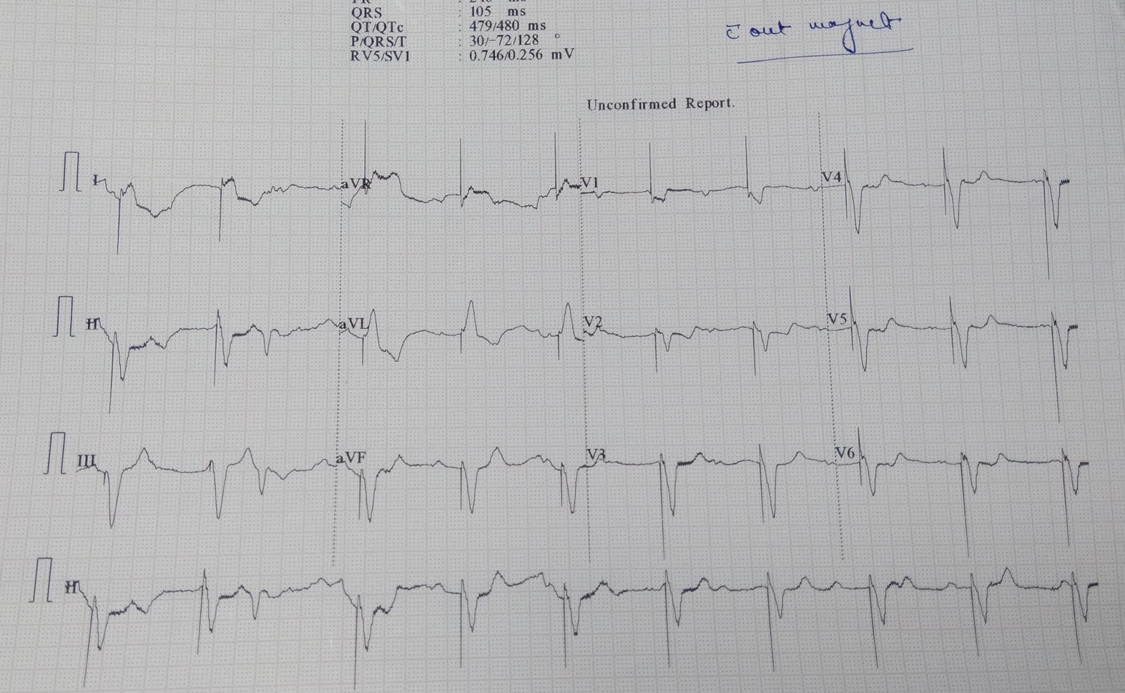 Cardiology window: Pacemaker failure to capture