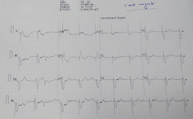 Cardiology window: Pacemaker failure to capture