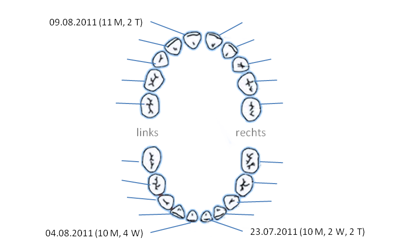 Isn Ding wa??: Zahn #3