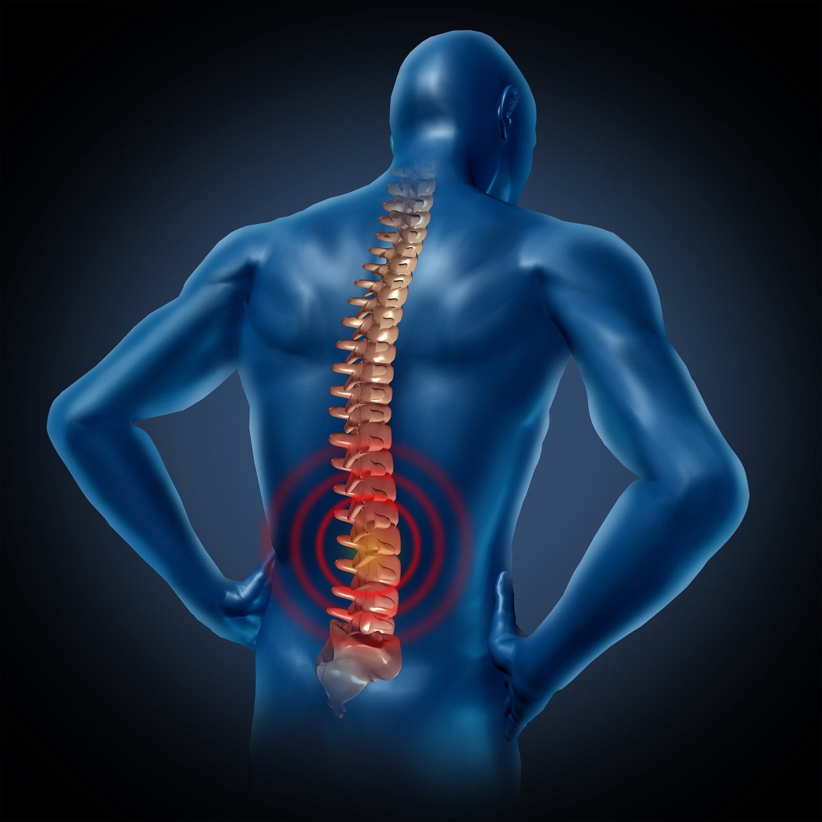 Spinal Cord Injury:Types and Treatment