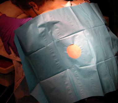 Dr. Saif ALaa ALqaisy: lung thoracentesis puncture site and technique