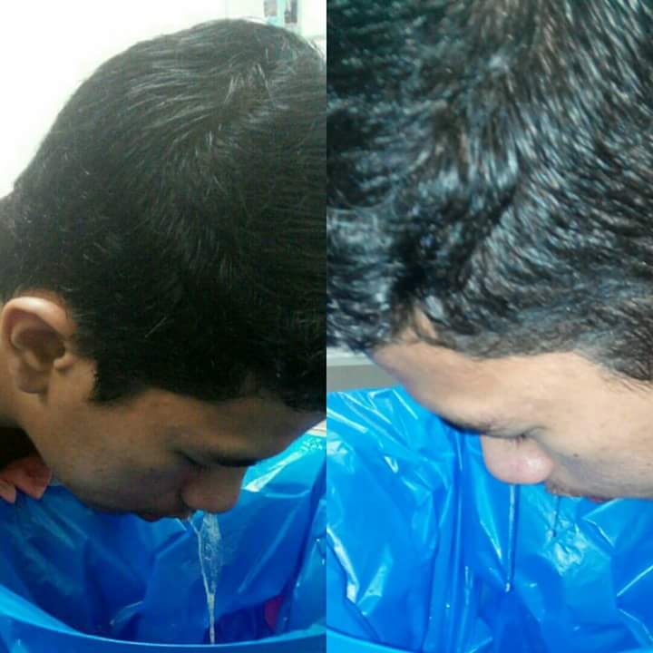 Al-Ansar Health Kuantan: RAWATAN RESDUNG