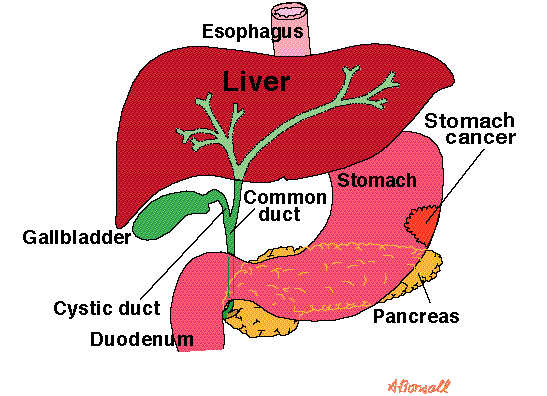 Kerap gastrik & sakit perut petanda awal kanser perut?