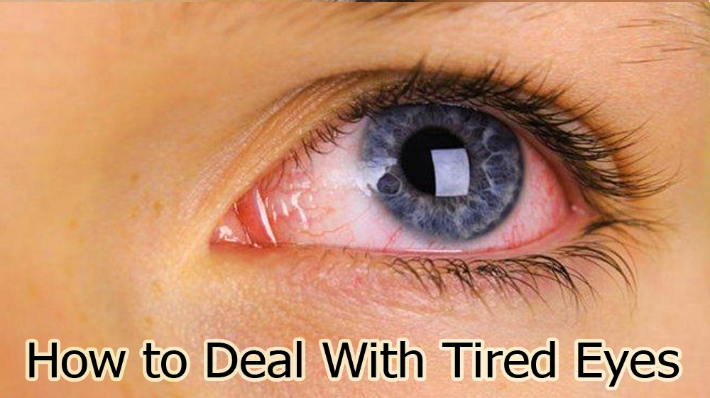 How to Deal With Tired Eyes
