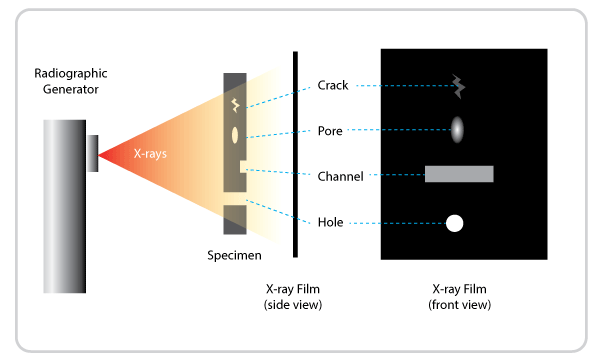 EDUCATION BLOG: X-RAY RADIOGRAPHY