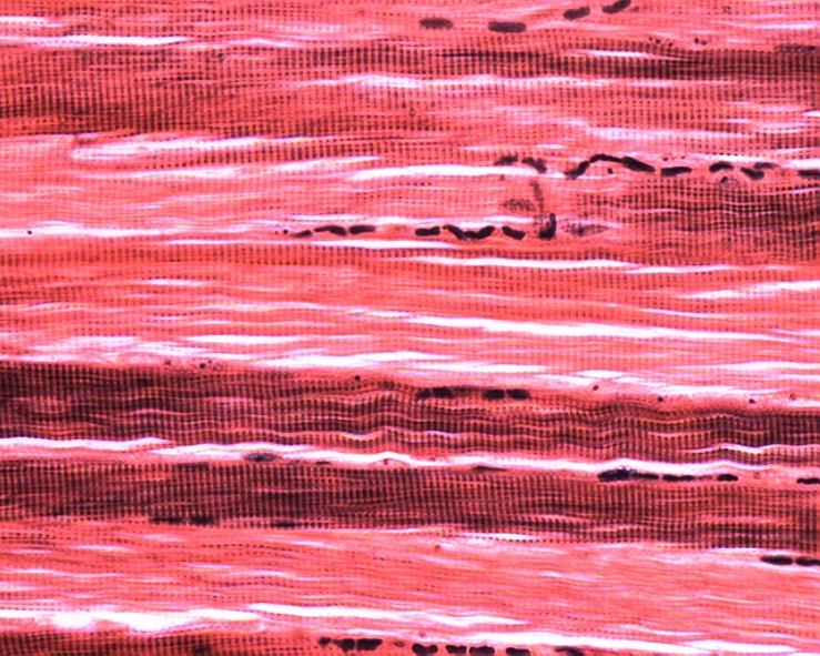 Within my Mind: Muscular System