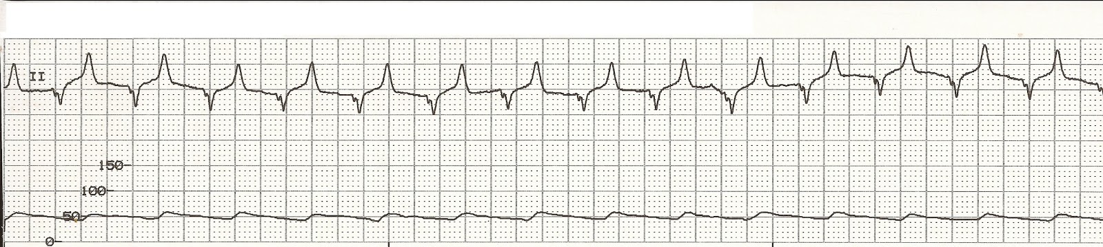 For in that sleep of death what dreams may come...