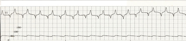 For in that sleep of death what dreams may come...