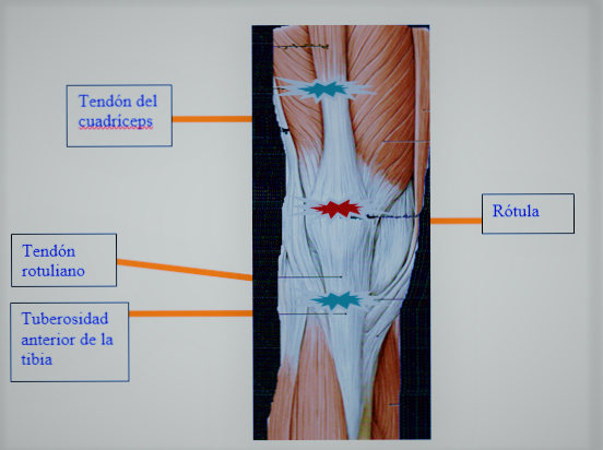 Mi viejo maletin: Trasplante de aparato extensor de rodilla tras una ...