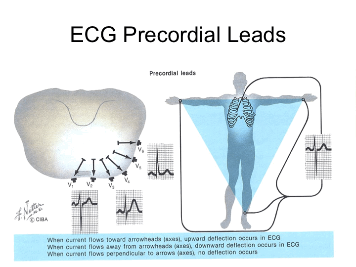 ECG ( Electocardiogram ) 12 leads ECG - Med Club