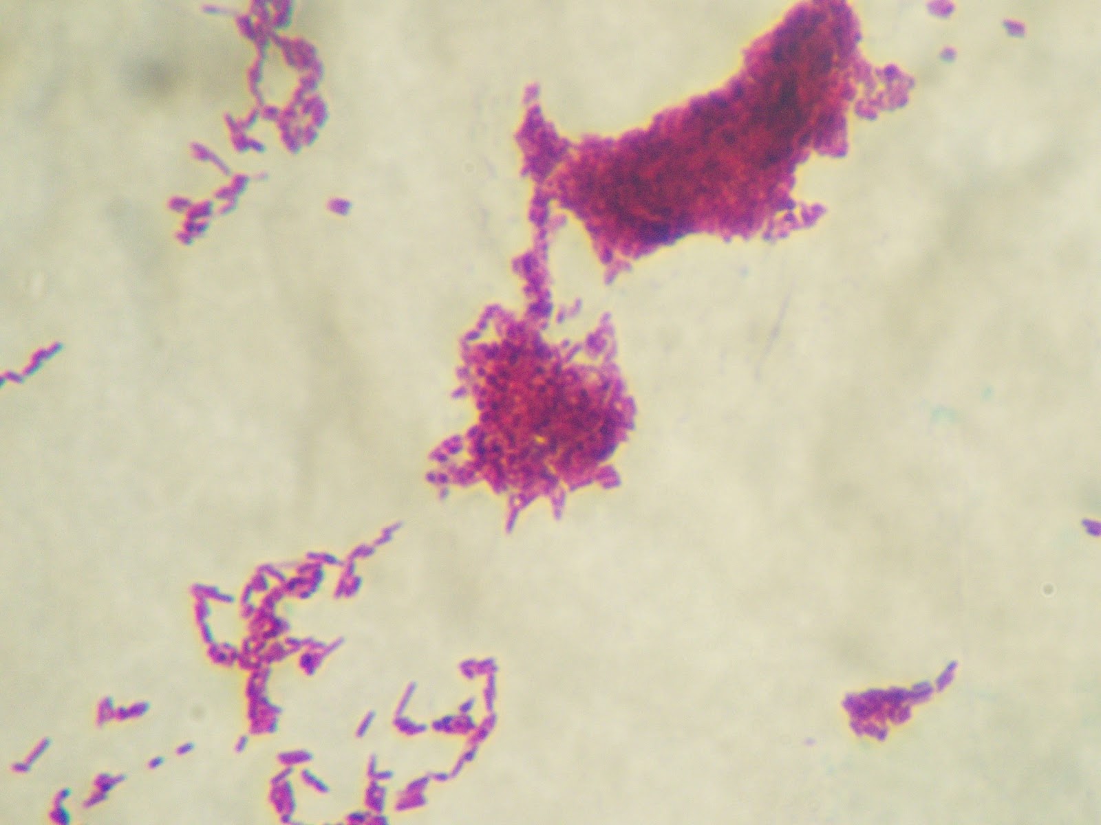 Lauren Sutton: 7-9-12