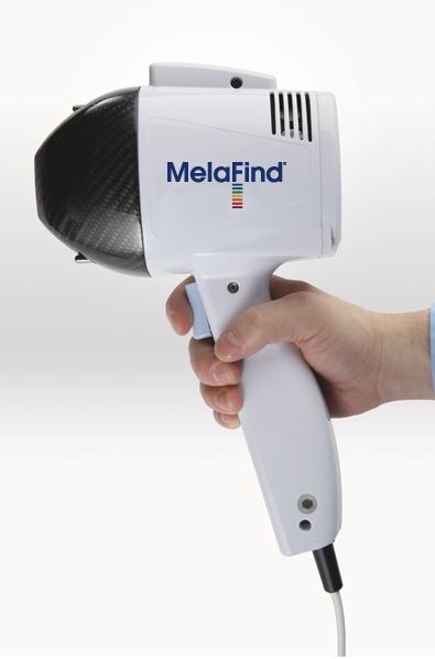 What Does Your Mole Look Like? MelaFind Can Help You! | SpoiledLatina