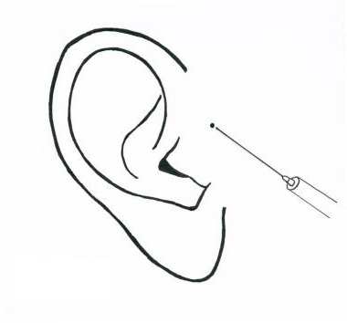 Medical-Review: Ear Anesthesia