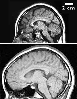 The genetics of emergent phenotypes