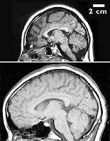 The genetics of emergent phenotypes