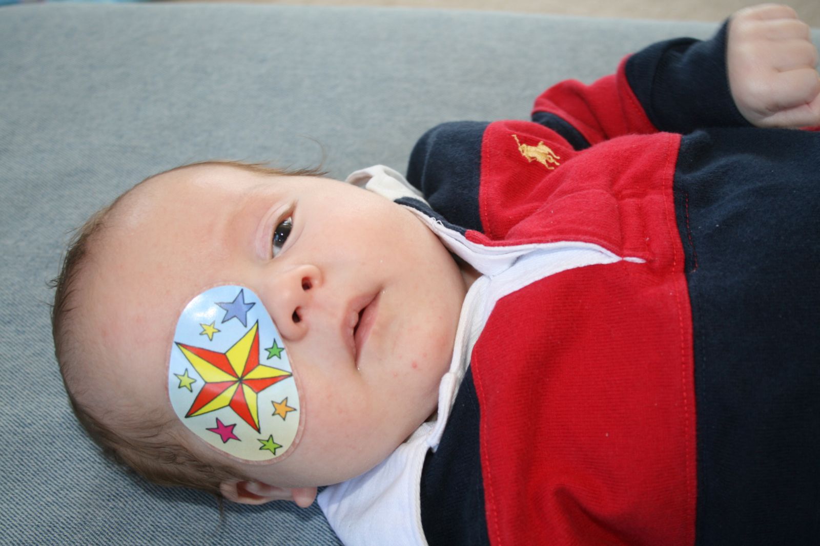 Tommy's Eyes: Fun Eye Patches