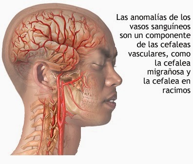CENTRO DE ENFERMEDADES NEUROLOGICAS - CHILLAN (CHILE): CEFALEA VASCULAR ...