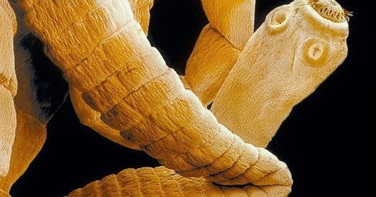 Medicina - facilitando fontes: O COMPLEXO TENÍASE/CISTICERCOSE